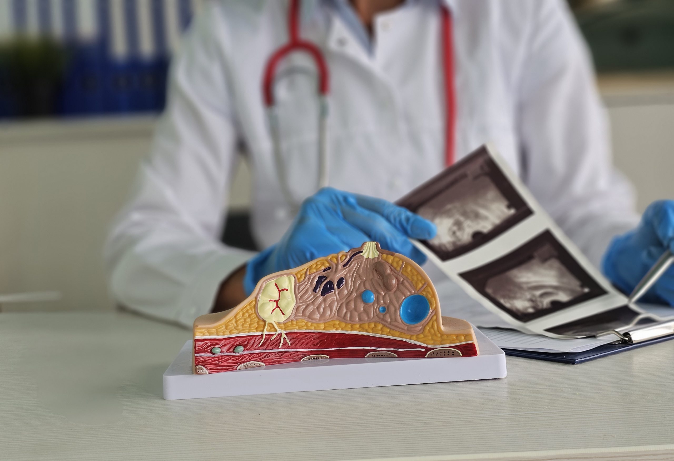 Prosedur Biopsi : Panduan dan Biaya Terkini
